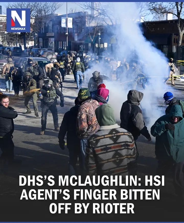JUSTIN:“Minnesota Chaos: Federal Officer’s Finger Bitten Off During ...